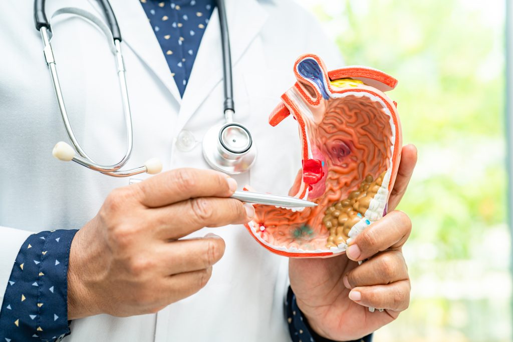 Exploring Gastric Balloons: A Non-Surgical Solution for Weight Loss ...