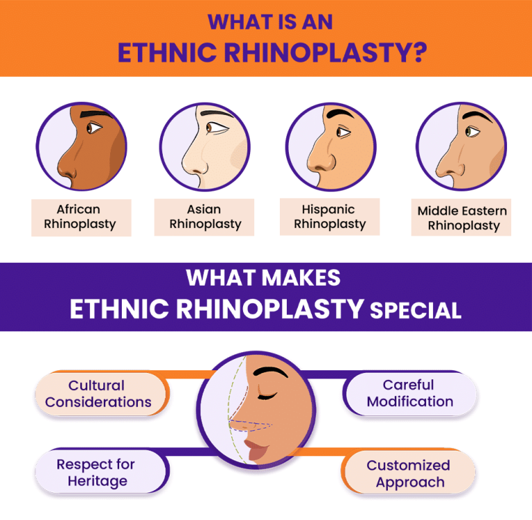 Ethnic Rhinoplasty: A Comprehensive Guide to Preparing, Enhancing, and ...